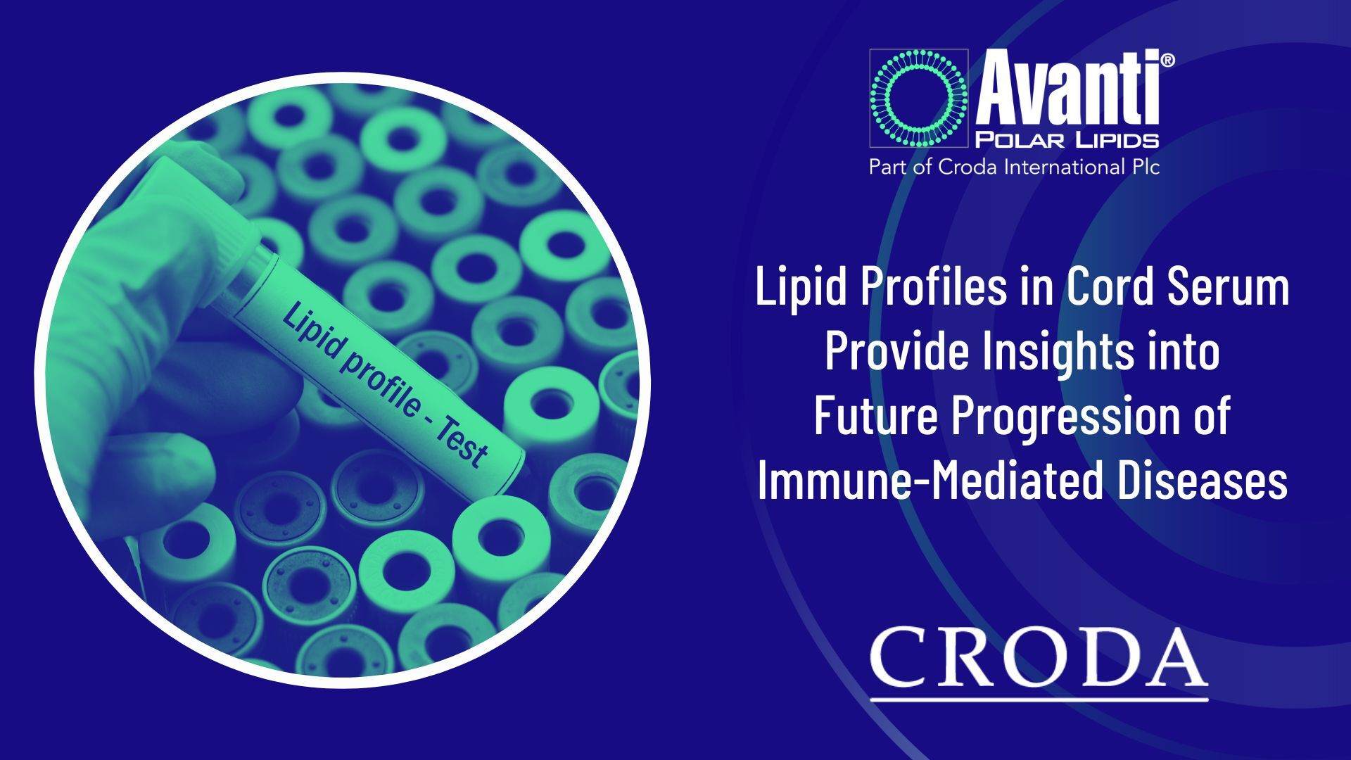 Lipid Profiles in Cord Serum Provide Insights into Future Progression ...